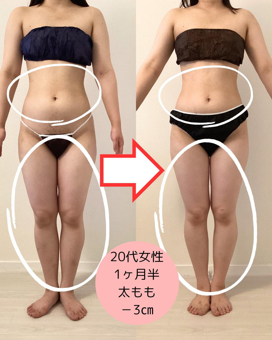 1ヶ月半ビフォーアフター☆脚むくみスッキリで－3㎝！ | 脚やせ専門ボディメイクB-CHERISH