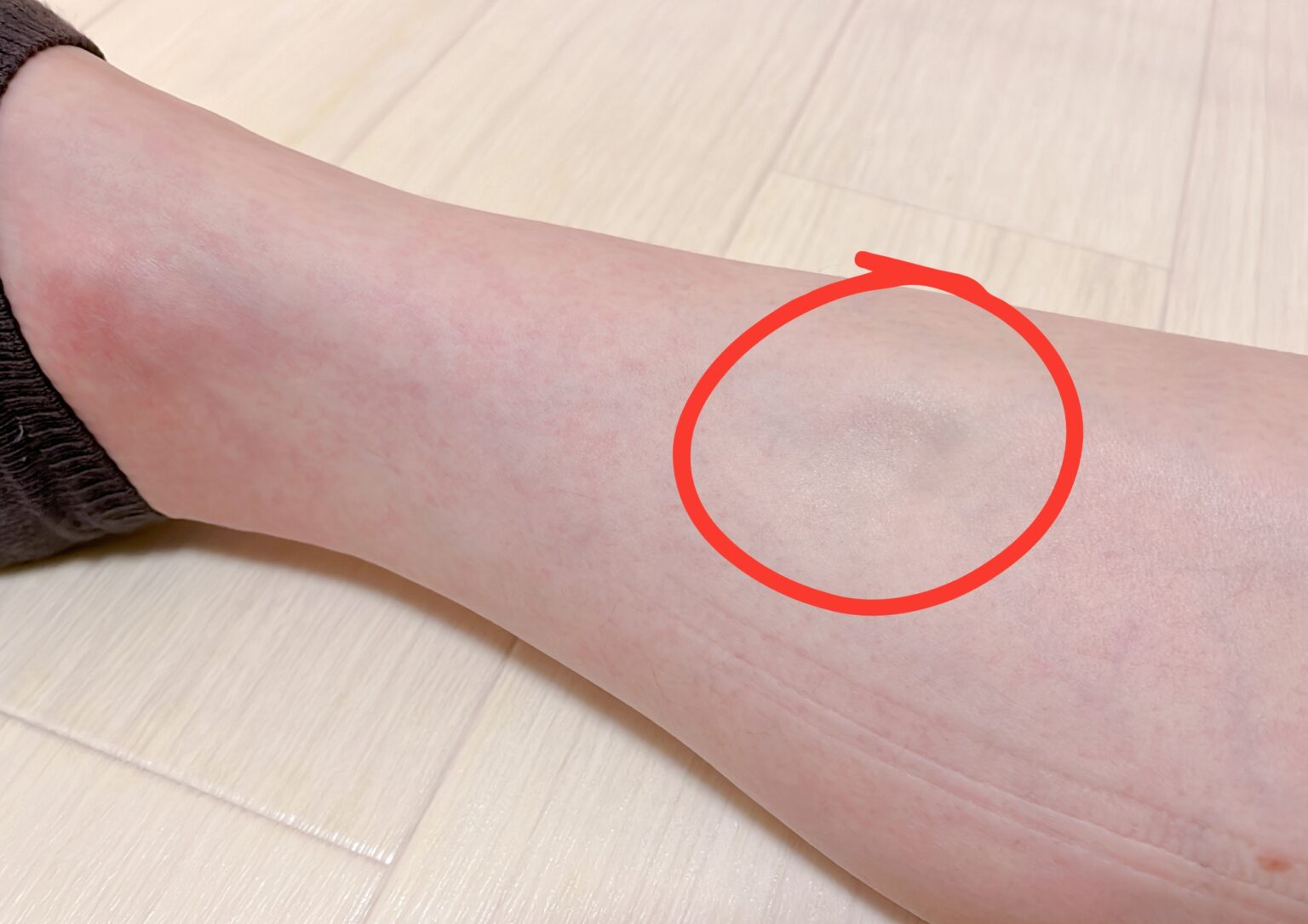 足のむくみセルフチェック！やり方とポイント | 脚やせ専門ボディメイクB-CHERISH