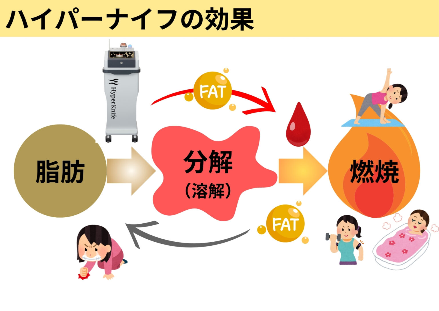 ハイパーナイフの効果的な施術頻度は？理想のペースで最短ルートの脚やせを目指そう！ | 脚やせ専門ボディメイクB-CHERISH