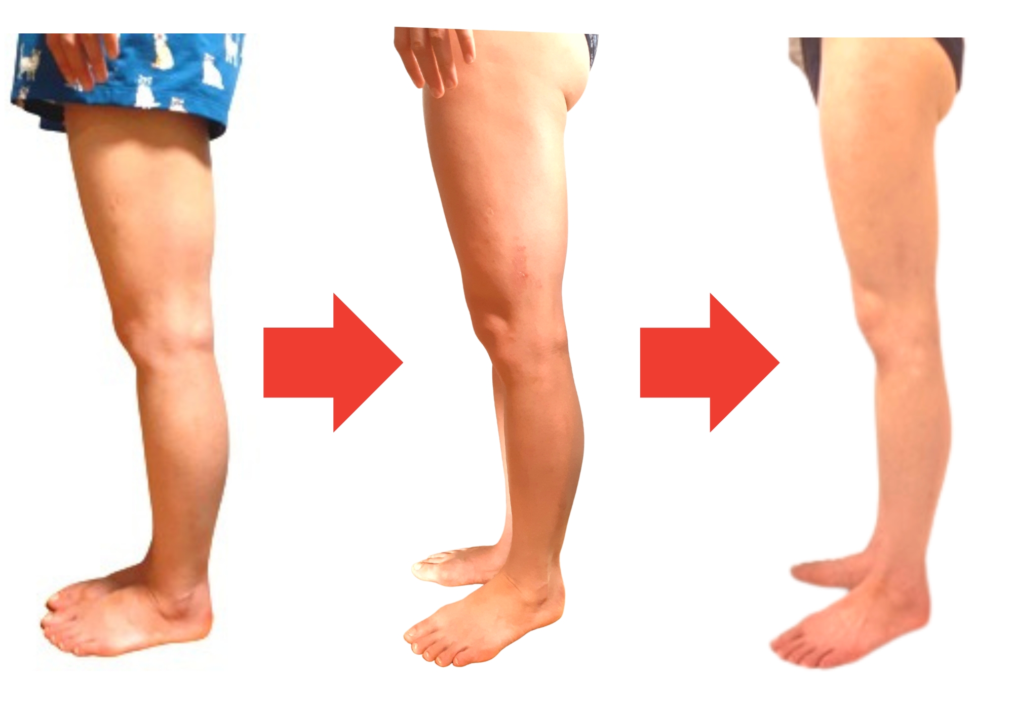 健康美脚にこだわる脚やせ専門プライベートサロンB-CHERISH／中野・新中野・東高円寺 | 脚やせ専門ボディメイクB-CHERISH